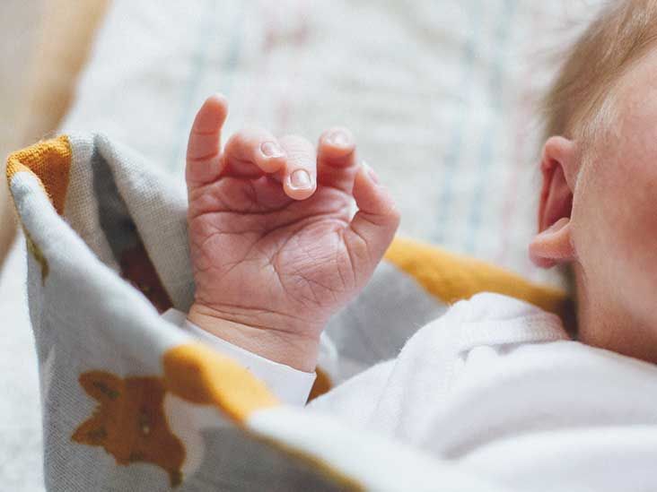 Proteus Syndrome: Symptoms, Treatment, Outlook, and More