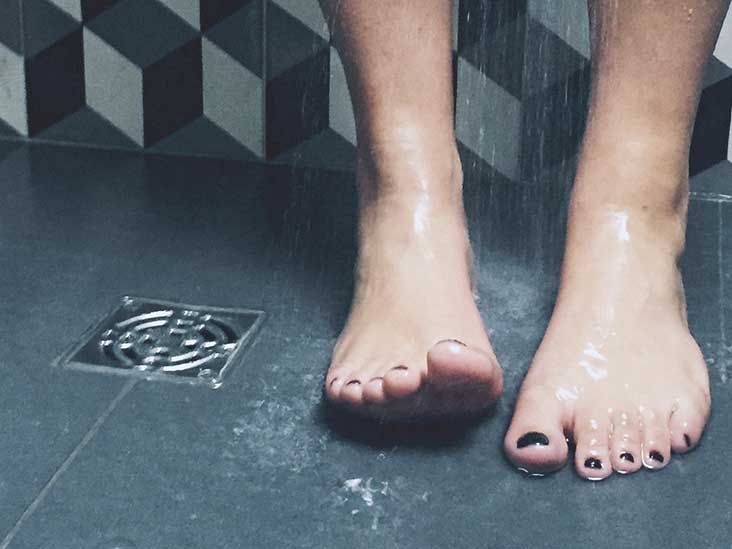 Bromhidrosis: Causes, Treatment, and More