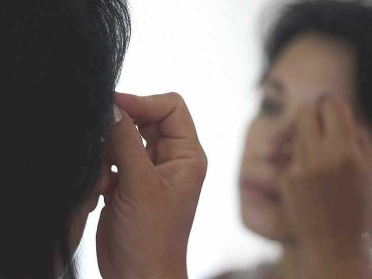 Malar Rash: Causes, Symptoms, Treatment, Picture, and More