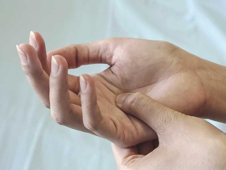 Rheumatoid Arthritis Severity Scale: How It Works and Outlook