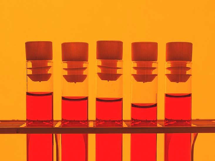 HIV Viral Load: Why This Number Matters