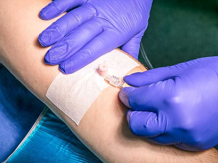 Central Venous Catheters: PICC Lines versus Ports