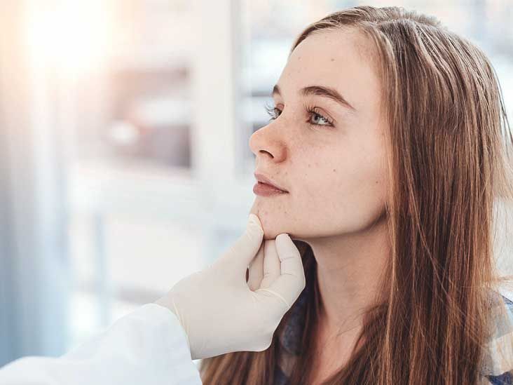 Skin Abscess: Causes, Diagnosis, and Treatment