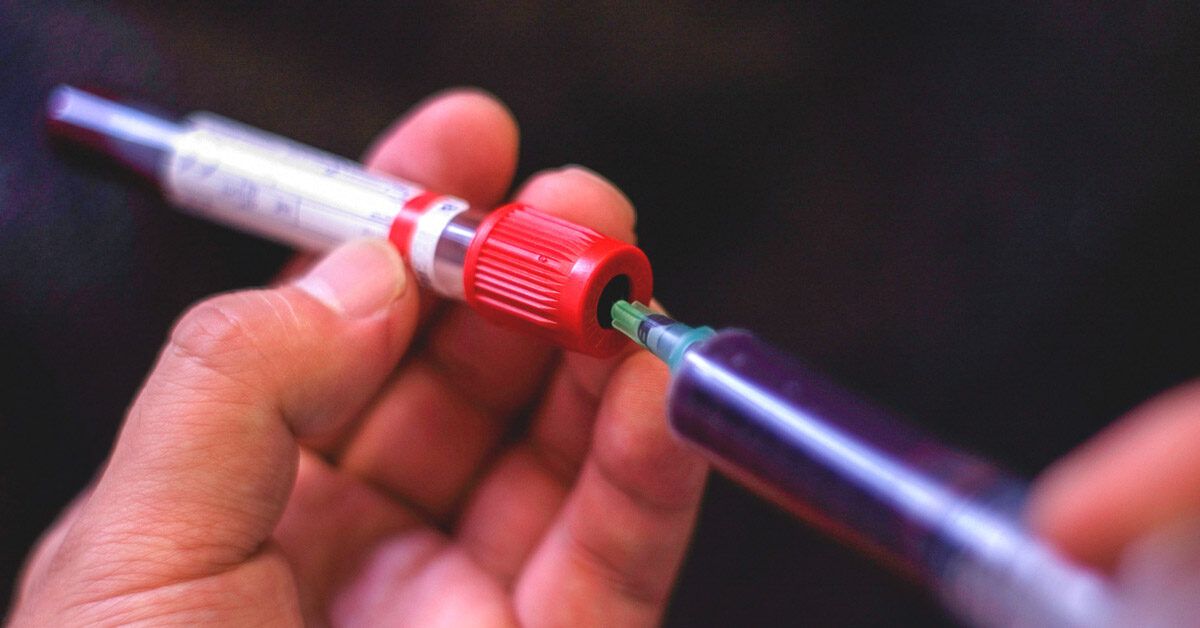 What Is MCH and What Do High and Low Values Mean?