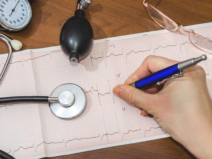 Trigeminy PVC: Definition, Causes, Treatment