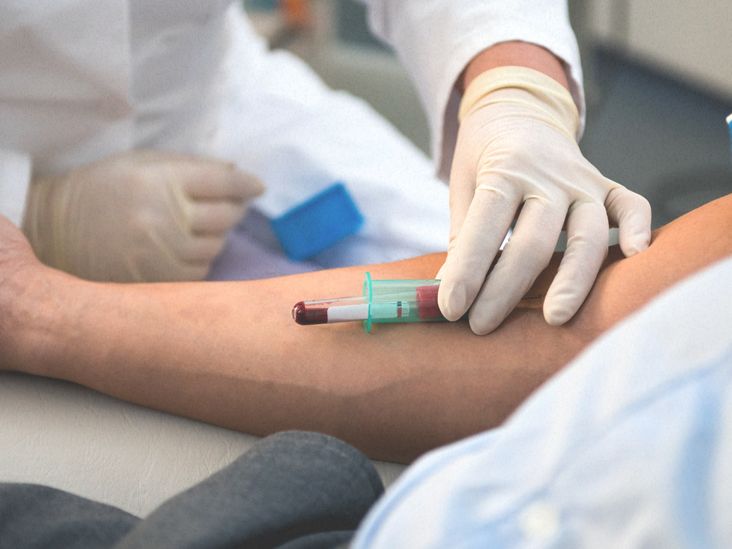 Polycythemia Vera: Symptoms, Causes, and Diagnosis