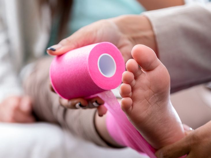 Fracture Blisters: Causes, Treatment, and How Long They Last