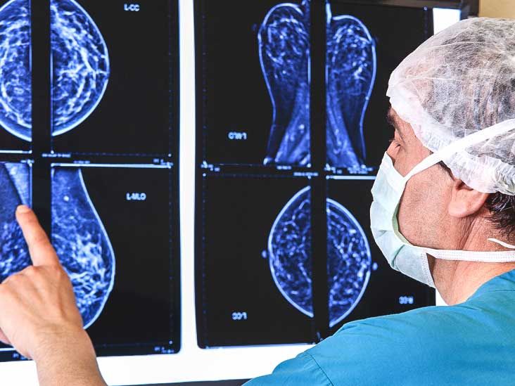 Understanding Your Mammogram Results