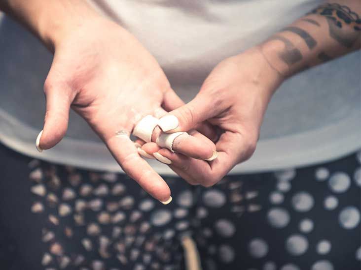 Blood Blister: Symptoms, Causes, Diagnosis