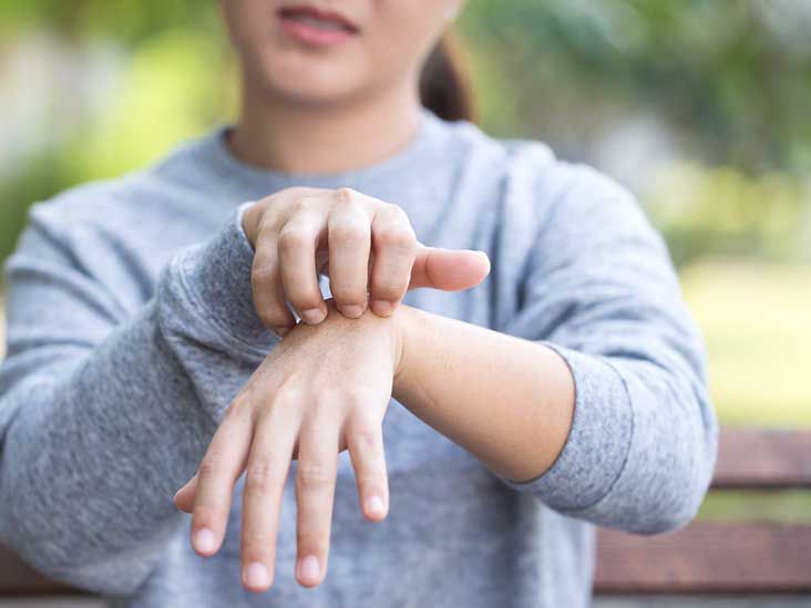 10 Skin Rashes Caused by Ulcerative Colitis