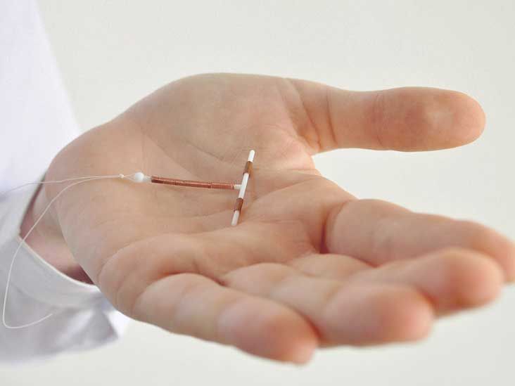 What to Expect If Your IUD Fell Out