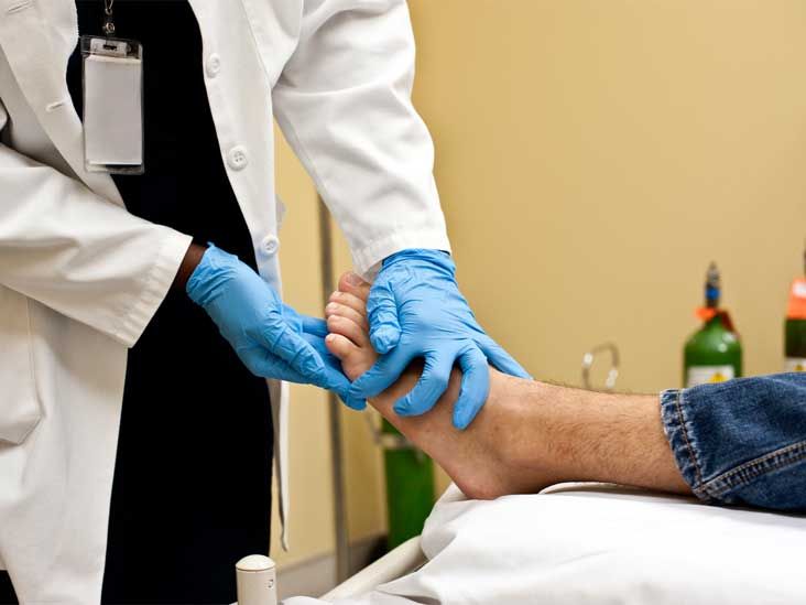 Palmoplantar Pustulosis: Causes, Symptoms, and Treatment