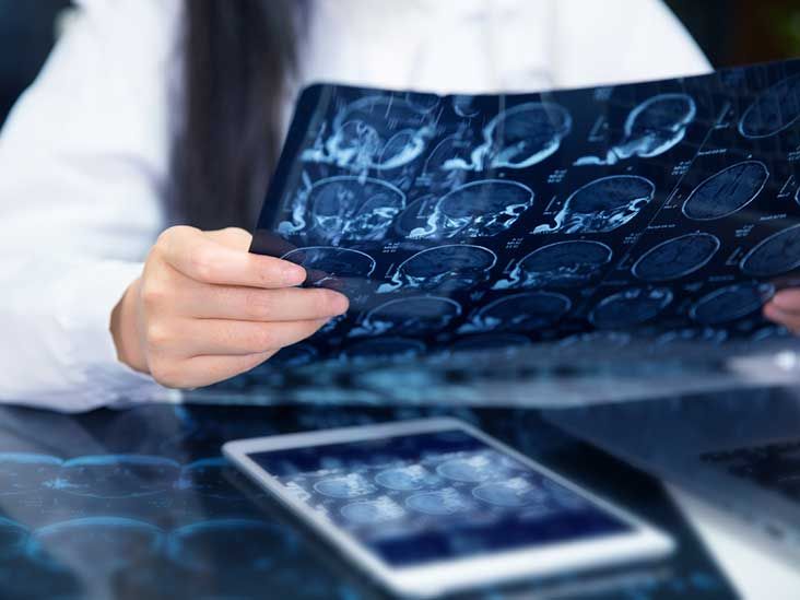 RRMS and PPMS: Differences in Symptoms, Treatment, and More