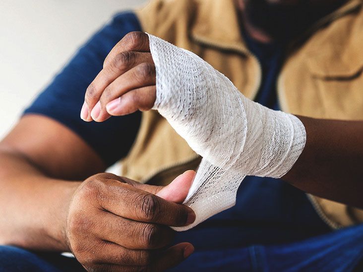 Cellulitis Home Treatment: Remedies Without Antibiotics, Warning Signs