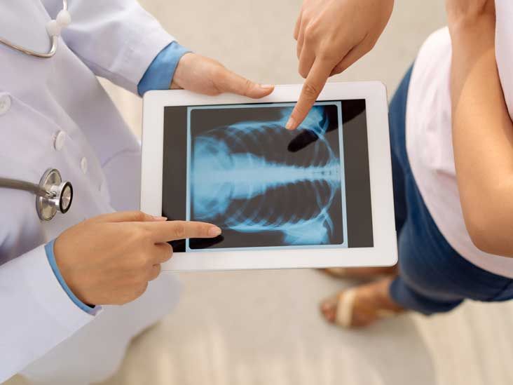 Lung Diffusion Testing: Purpose, Procedure, and Results