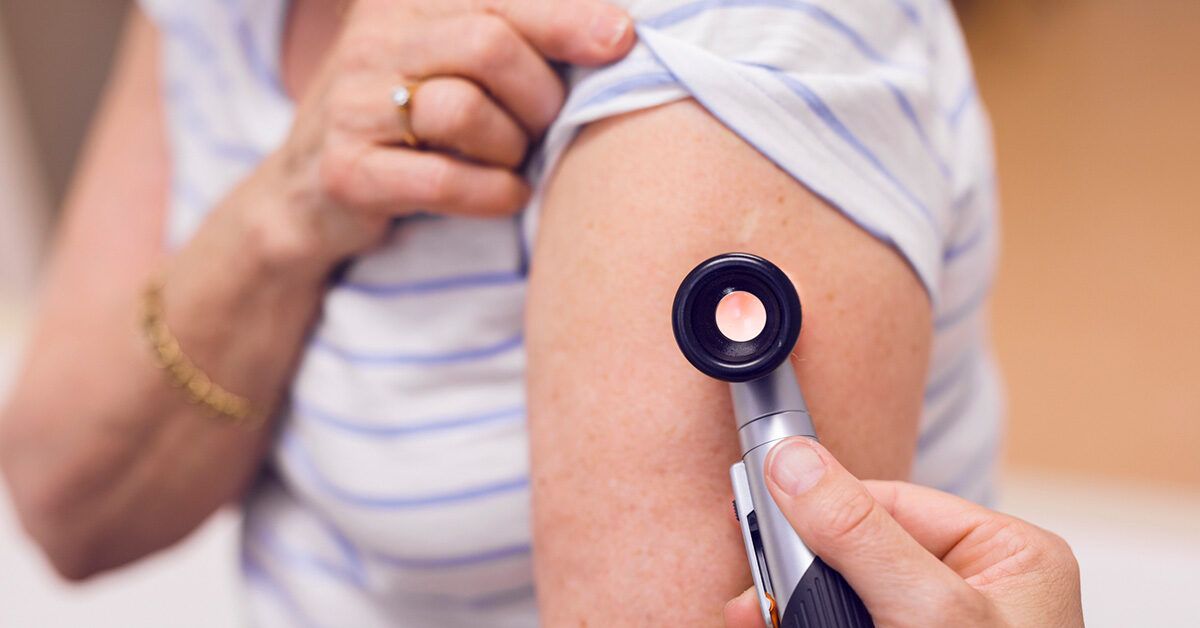 Psoriasis vs. Skin Cancer: Pictures, Knowing the Signs, and More