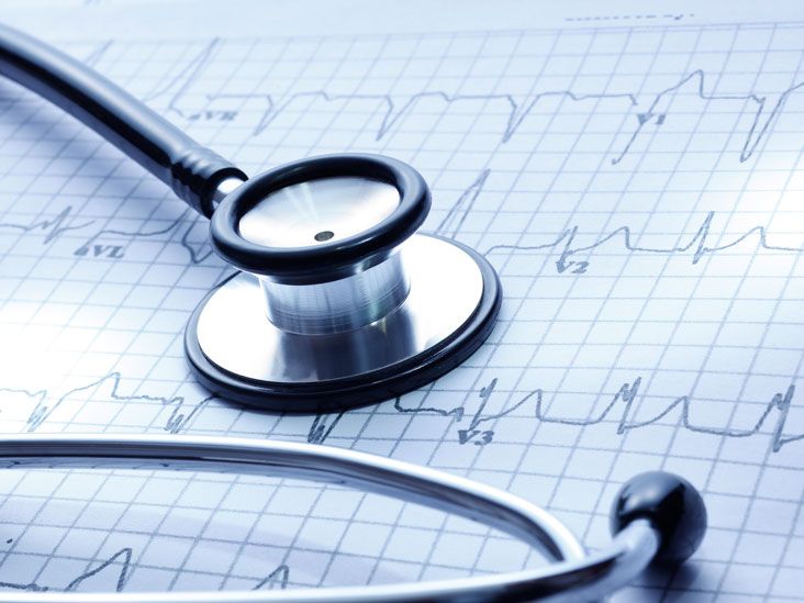 Abnormal Heart Rhythms: Types, Causes, Diagnosis, Treatment