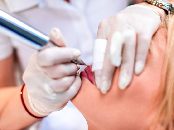Lip Blushing Tattoo Procedure, Benefits, Side Effects, Pictures