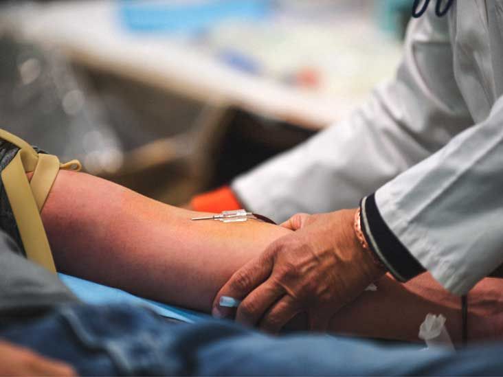 Polycythemia Vera (PV) Tests: Types and Lab Values