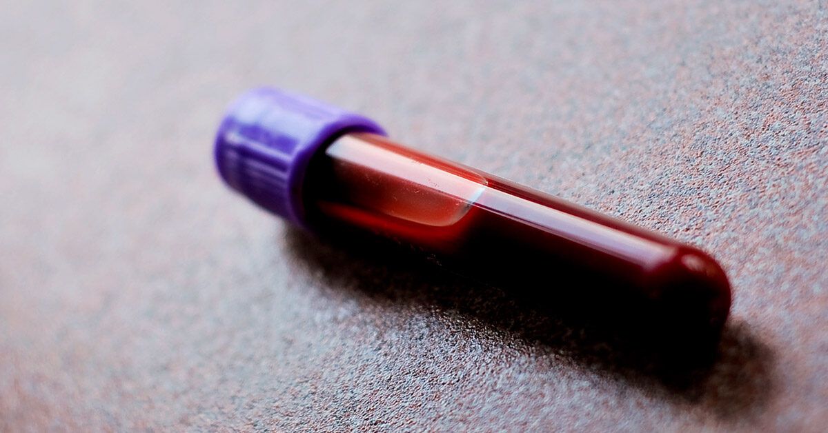 GAD Antibodies and Diabetes: What You Should Know