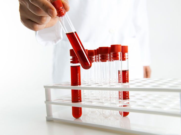 CA-125 Blood Test: Purpose, Procedure, and Risks