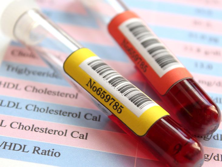 Lipid Panel Cholesterol Test: Ranges, Procedure, and Results