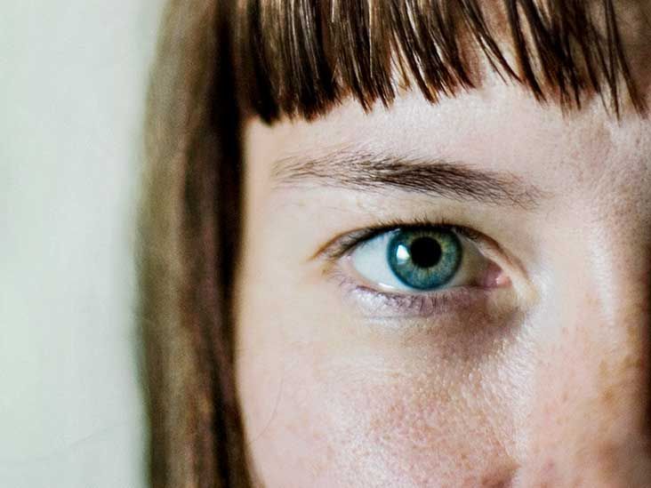 Skin Tags on Eyelids: Causes and Removal Treatment