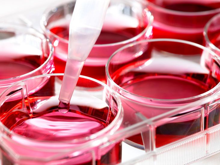 CPK Isoenzymes Test: Purpose, Procedure & Results