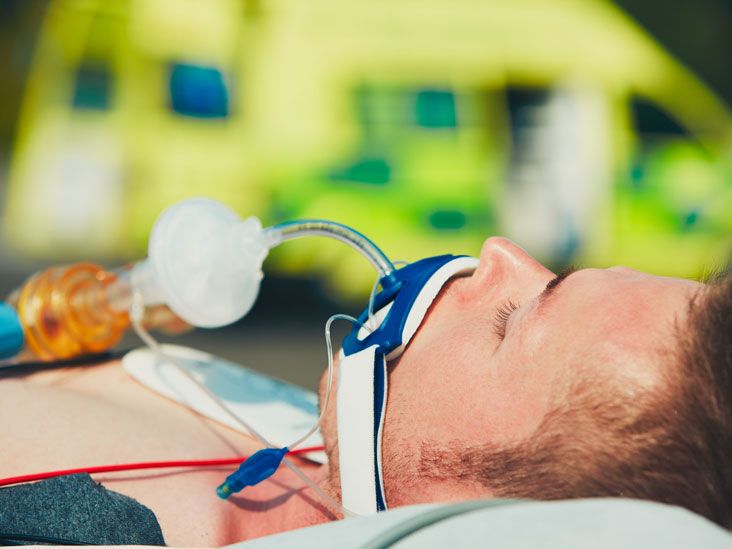 Endotracheal intubation: Purpose, Procedure & Risks