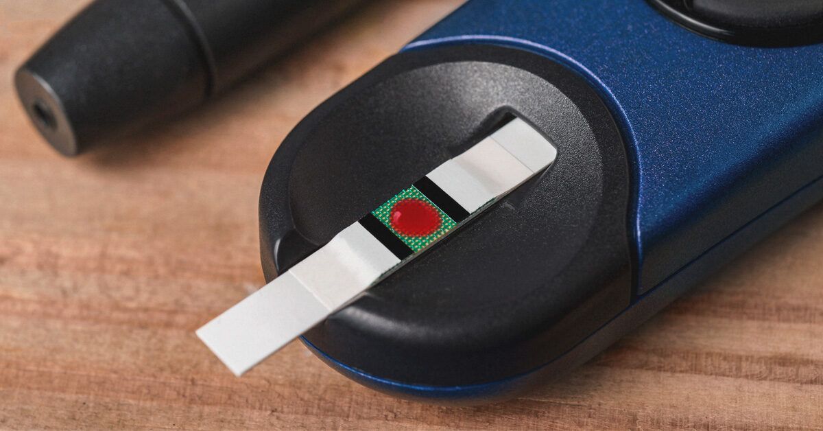 Random Glucose Testing: Why It’s Important