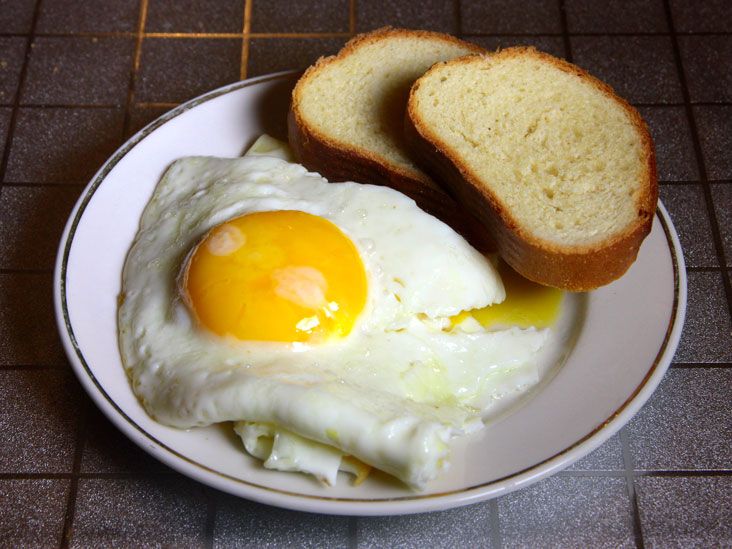 High Blood Cholesterol and Triglycerides (Lipid Disorder)