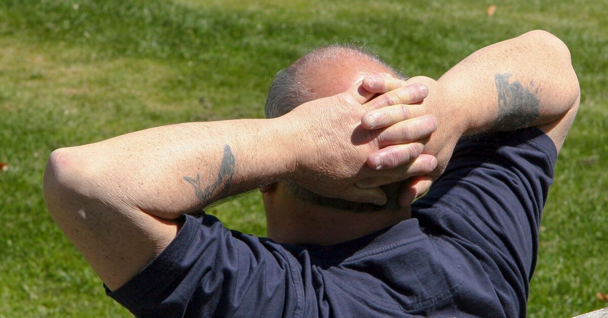 Sunburned Scalp: Symptoms, Treatment, and Prevention