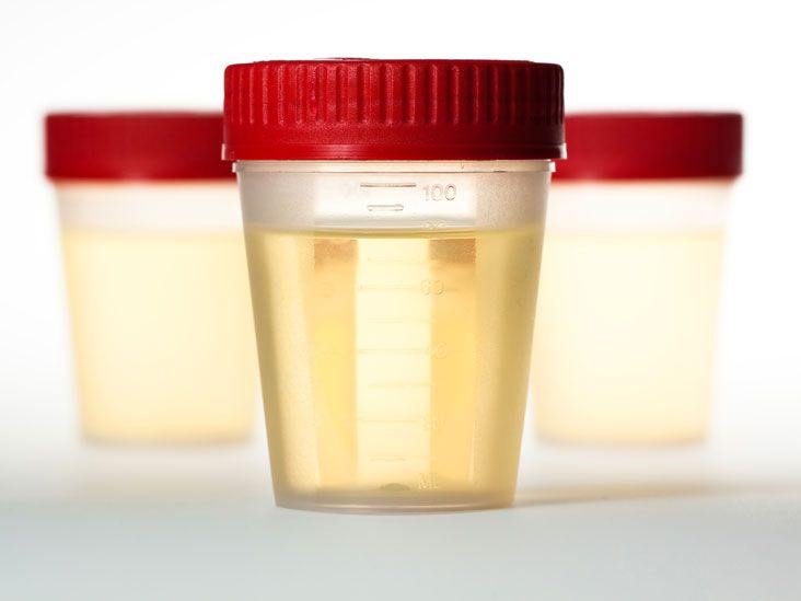 Urine Protein Test: Purpose, Procedure, and Preparation