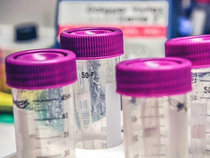 Urine Tests for Diabetes: Purpose, Procedure, and Results