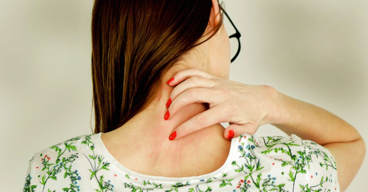 Mosquito Bite Allergies: Symptoms and Treatment