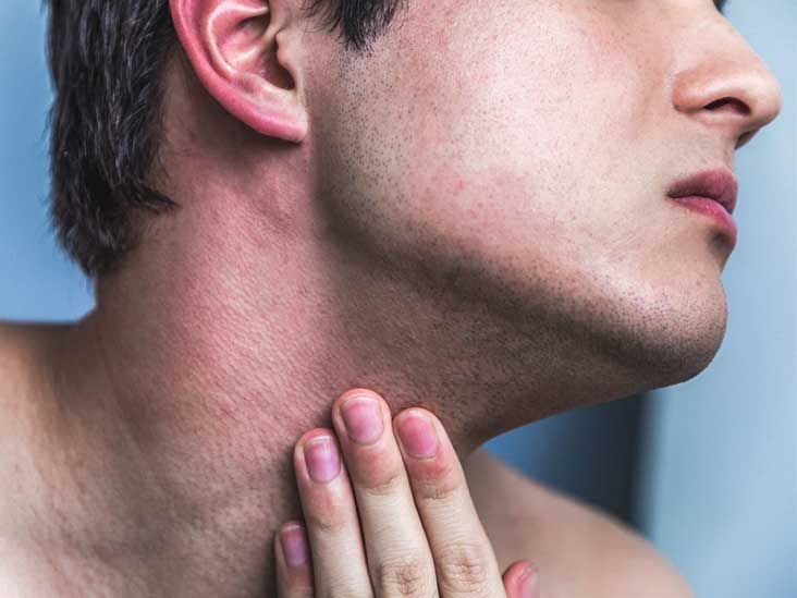 What Are Blemishes, and How Can You Get Rid of Them?