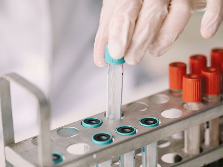 Double Marker Test: How It’s Done and What Results Mean