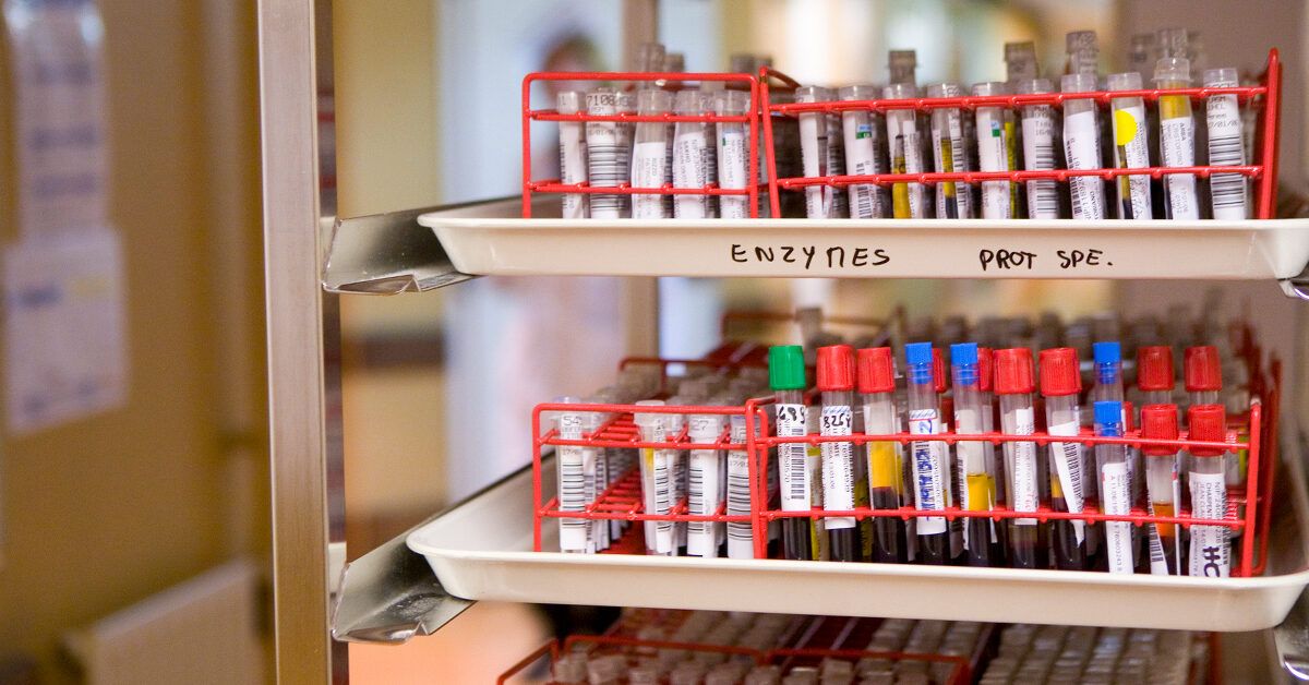 Mononucleosis Spot Test: Overview, Procedure, and Complications