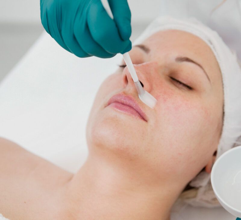 PCA Peel: Procedure, Aftercare, Side Effects, Cost, and More