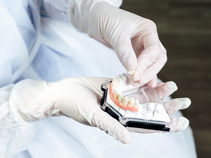 Partial Dentures: Cost, Types, and How to Choose
