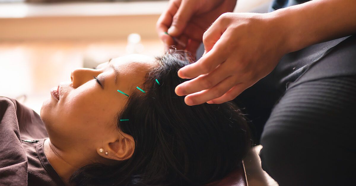 How to Stop Smoking Naturally: Acupuncture, Herbs, and More