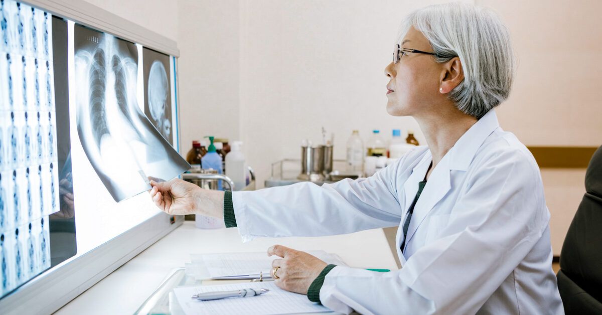 Lung Cancer Pictures: CT Scan, X Ray, and More