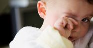 Baby Red Around Eyes Causes And Treatments