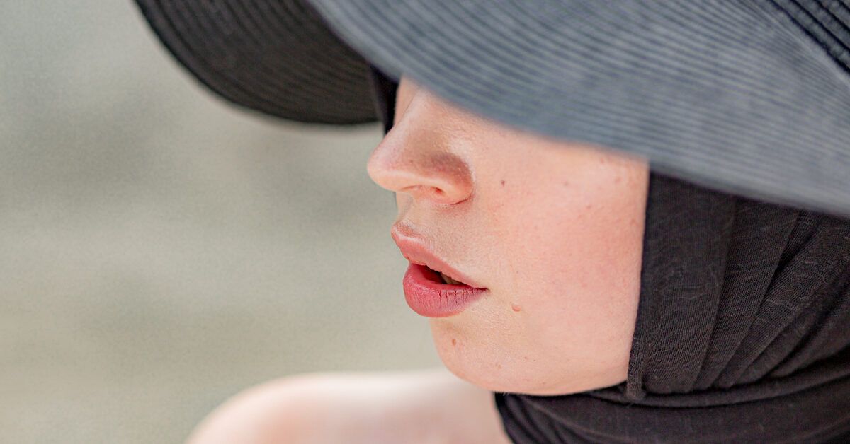 Closed Rhinoplasty: Procedure, Pictures, Cost, and Recovery