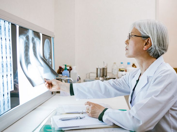 Lung Cancer Pictures: CT Scan, X Ray, and More
