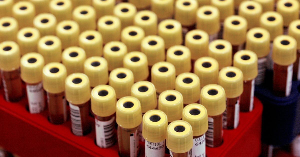 HDL Cholesterol: What It Is, and How to Boost Your Levels