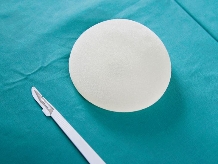 Pregnant with Implants: Frequently Asked Questions
