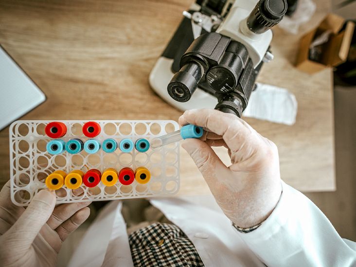 Toxoplasmosis Test: Procedure, Results, Treatment & More