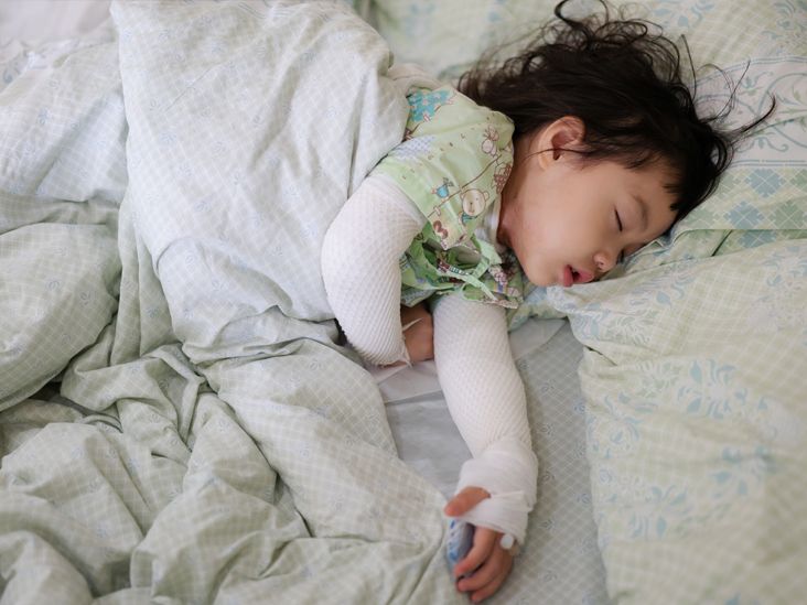 Wet Wrapping to Help Manage Eczema Flare-Ups