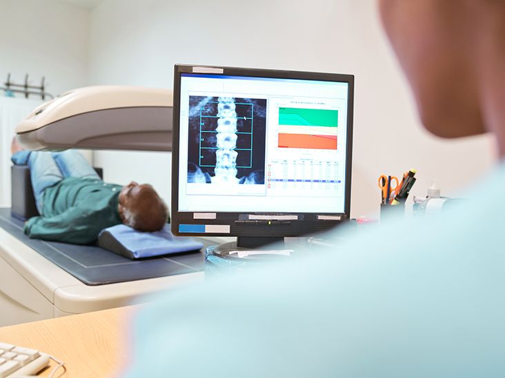 Does a Bone Density Test Show Arthritis? Uses, Results & More